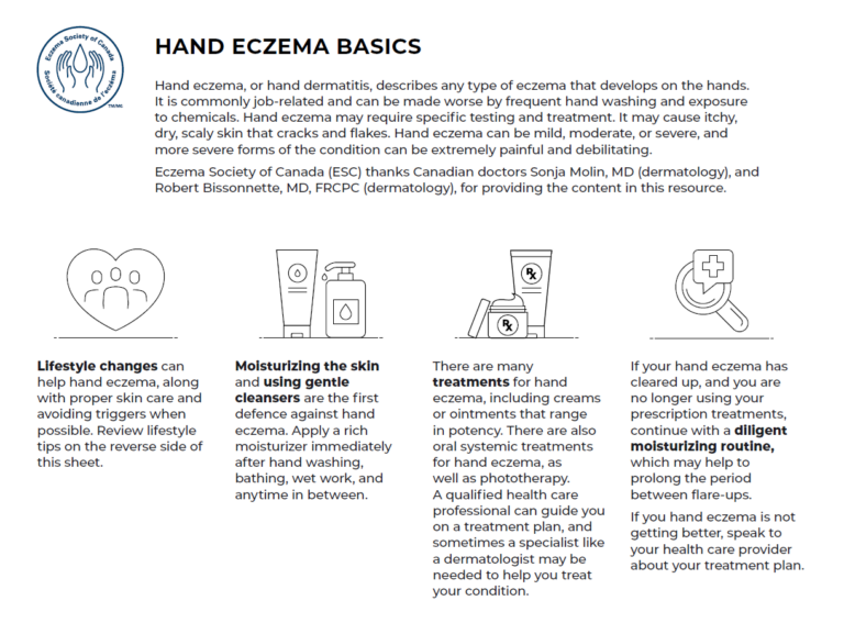 Treating Hand Eczema | Eczema Society of Canada